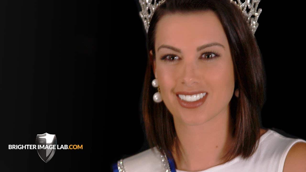 Pageant Queen Gets Dazzling Smile With Incredibil Veneer - Dental ...