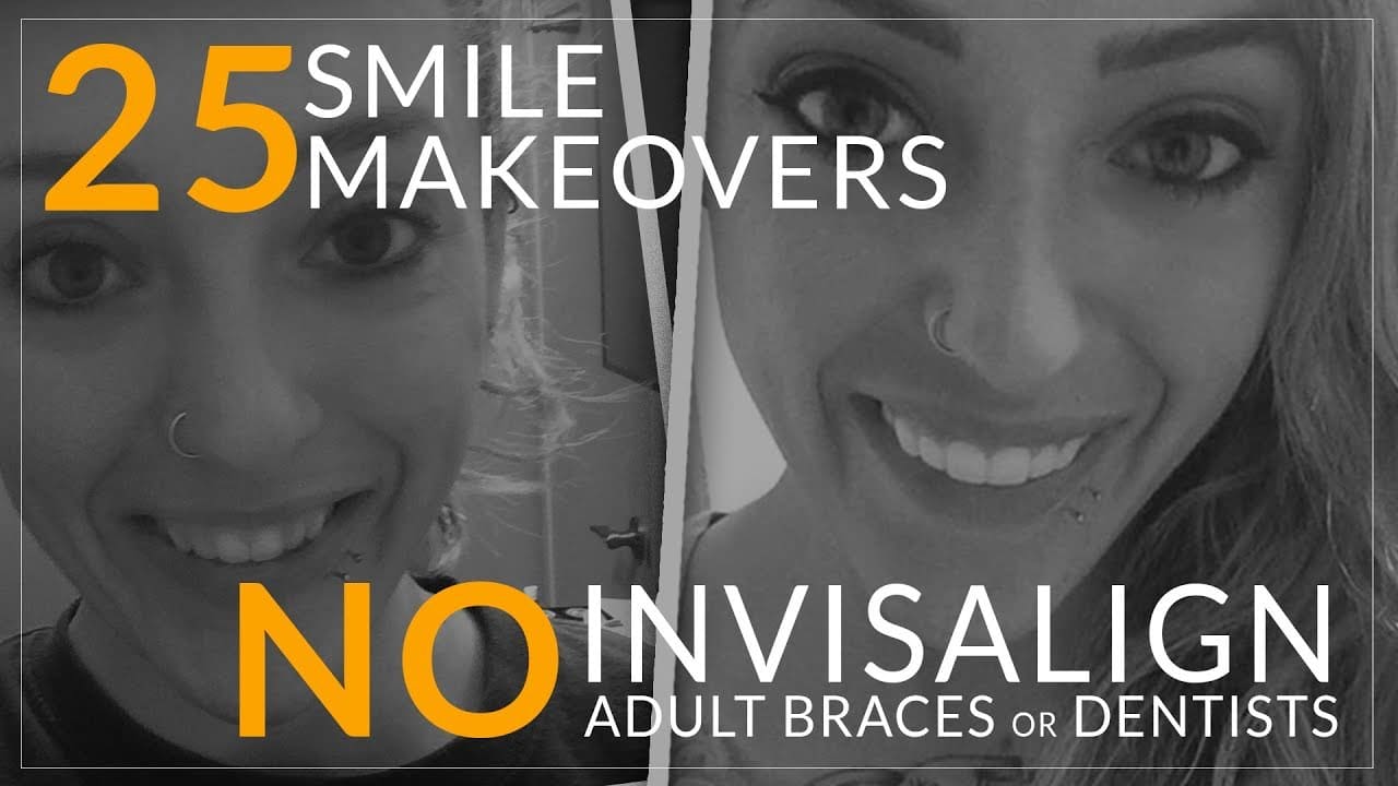 25 Breathtaking Before and After Smile Makeovers