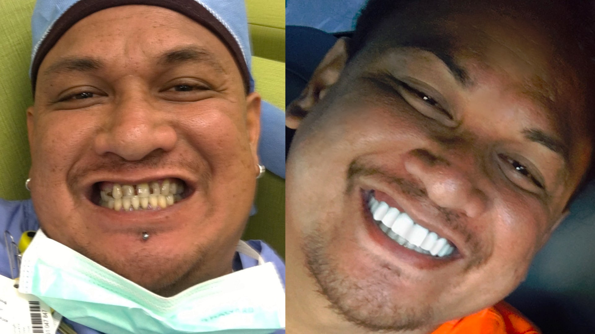 Makeup Artist Impressive 10 Minute Smile Makeover