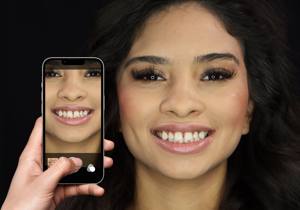 Upload Your Photos to Fix Your Smile at Brighter Image Lab - Dental Veneers | Brighter Image Lab